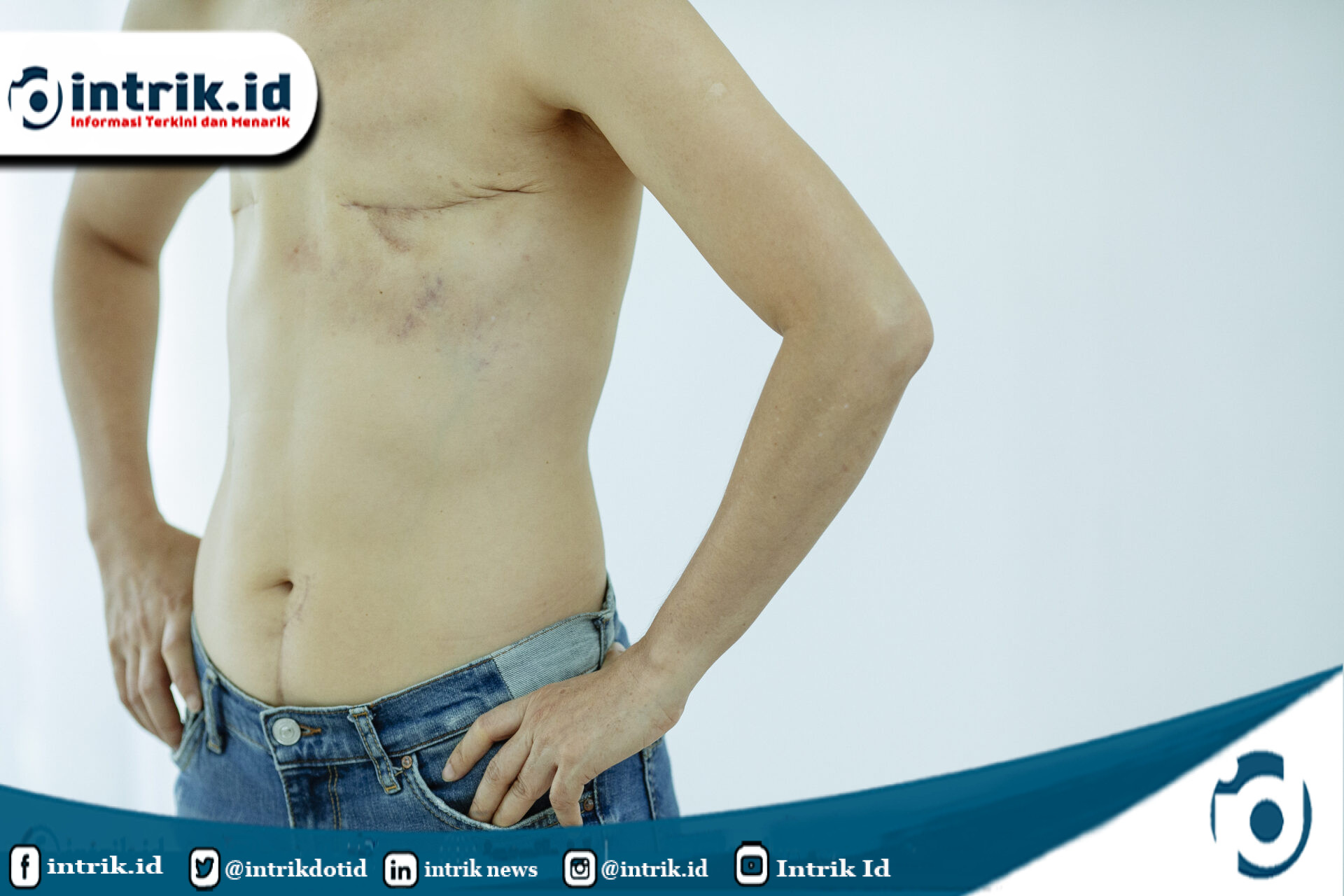 Kesalahan yang Sering Terjadi Saat Merawat Luka Bekas Operasi | INTRIK.ID